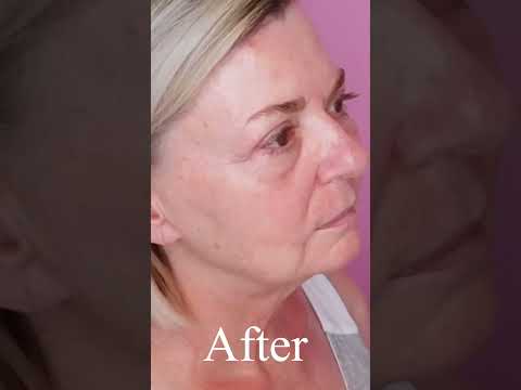 OVER 60 SKINCARE RESULTS! AMAZING!