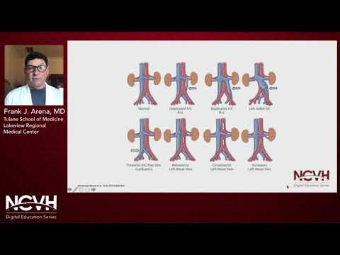 Dr. Frank Arena, How to Manage IVC Thrombosis