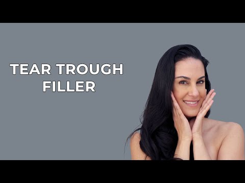 Tear Trough Filler | Nazarian Plastic Surgery