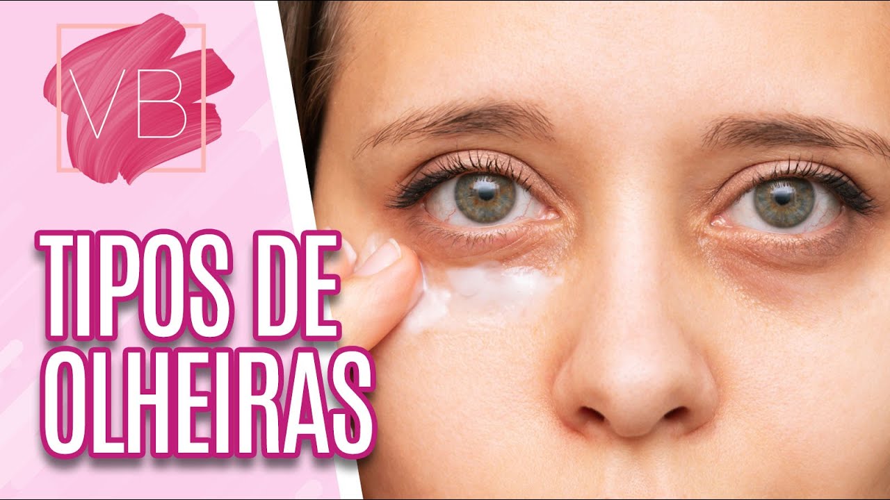 Conheça os tipos de olheiras e seus tratamentos - Você Bonita (02/08/2023)