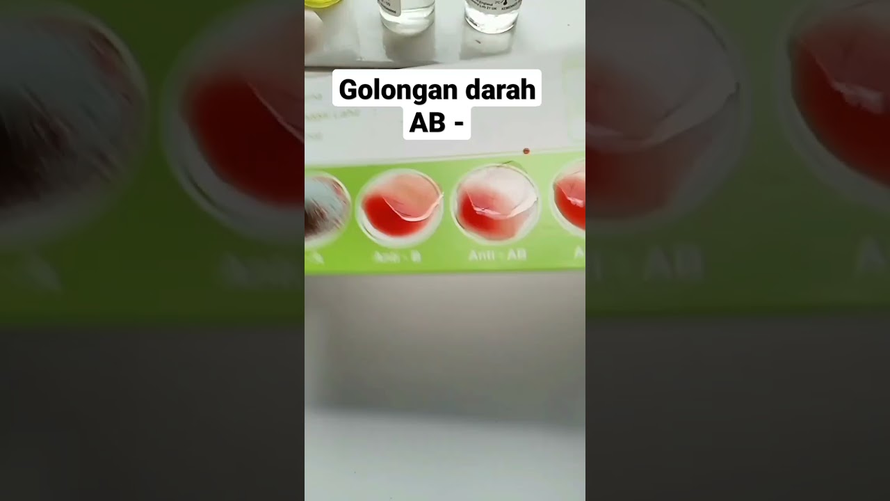 pemeriksaan Laboratorium golongan darah AB -