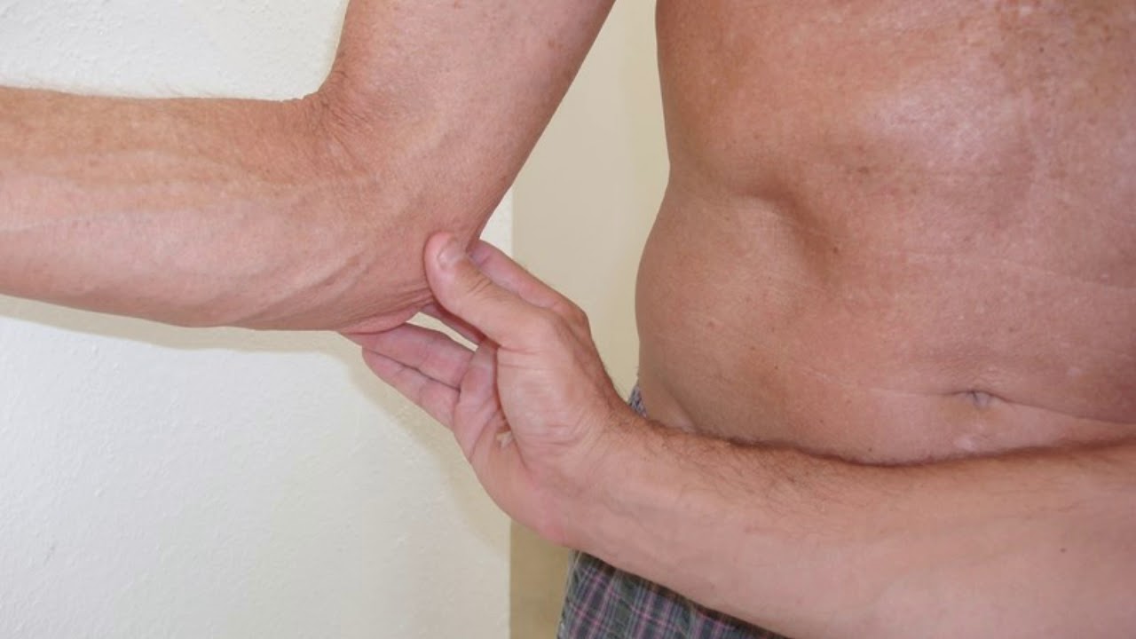Difference Between Condyle and Epicondyle