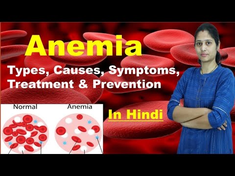 Anemia | Types of Anemia | Causes, Symptoms, Treatment, Prevention, Risk Factors | In Hindi