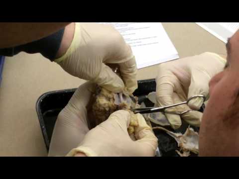 Optic Chiasm