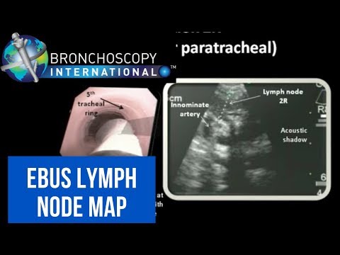 EBUS Lymph Node Map - Nodal Anatomy