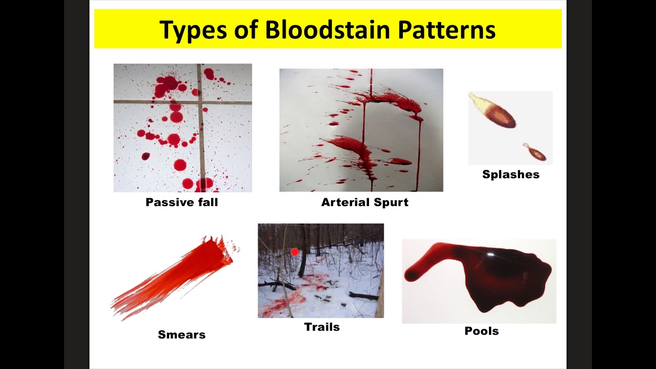 Blood Spatter Notes Forensics