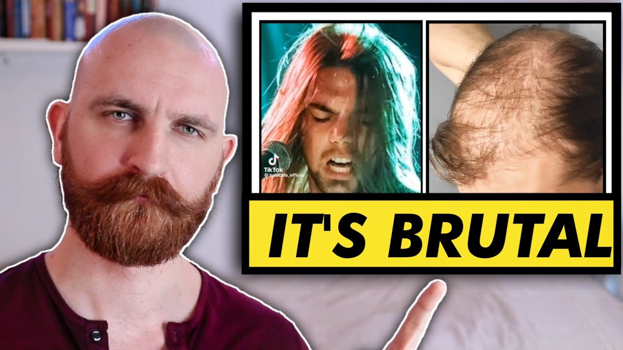 Balding is Depressing (This is WHY)