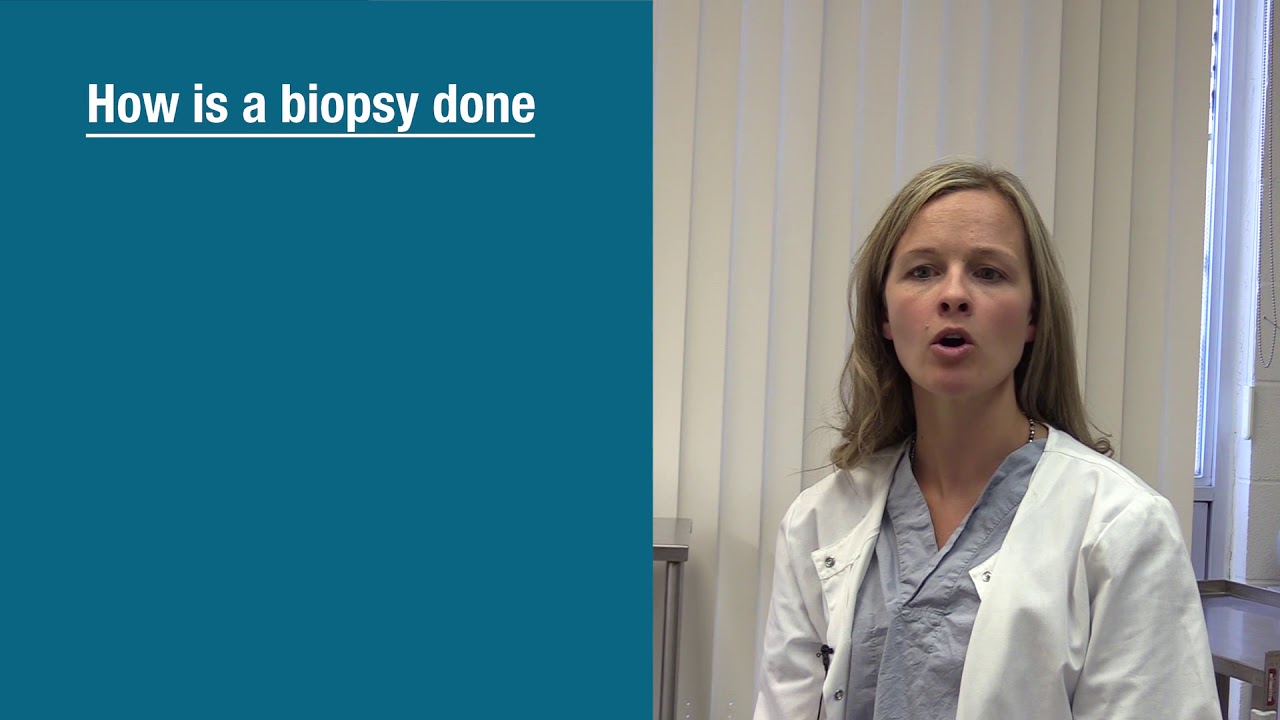 A Patient’s Guide to Colposcopy: What to Expect When Having a Colposcopy.