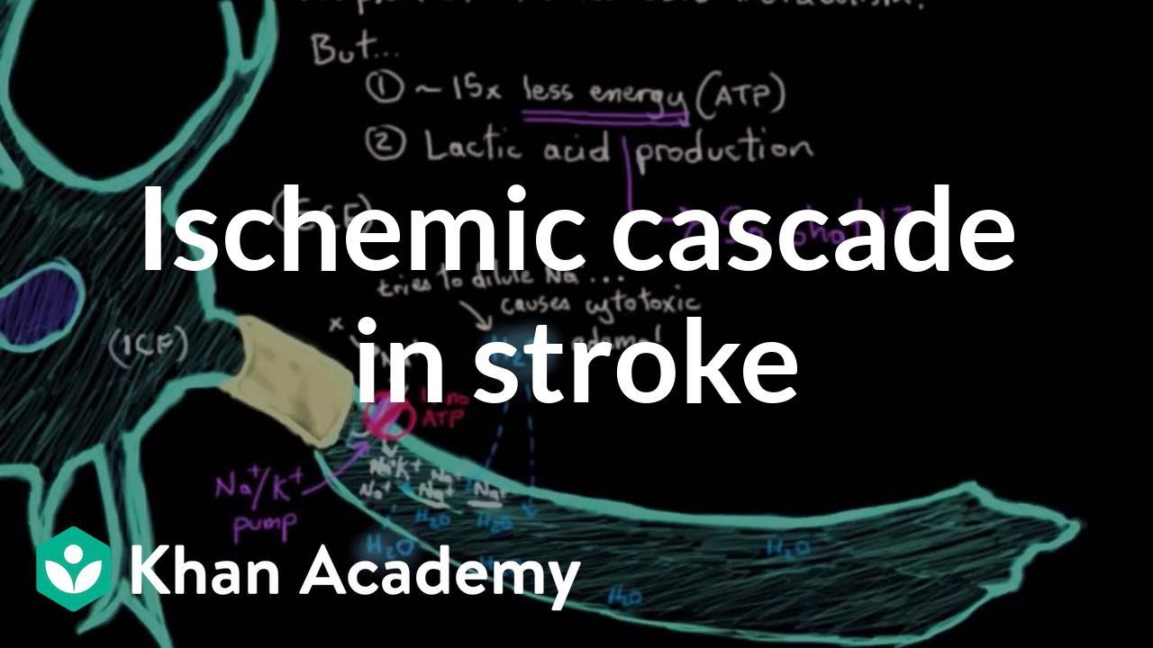 Understanding the Ischemic Cascade in Stroke: A Cellular Perspective ...