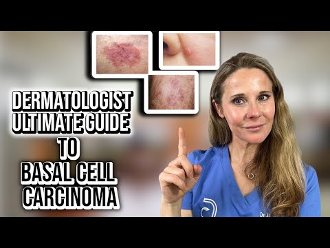 Dermatologist ultimate guide to Basal Cell Carcinoma