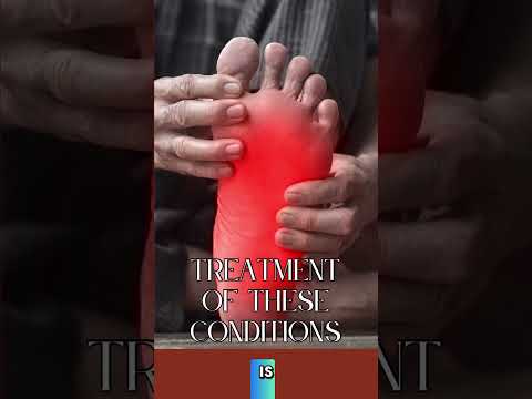 How to Treat Common Foot Conditions Hammer, Claw, & Mallet Toe: The Power of Physiotherapy