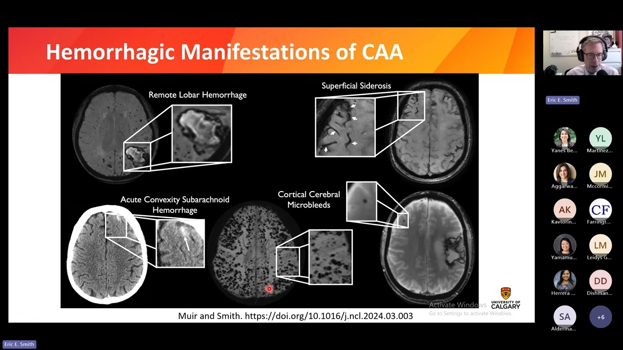 GRASP Frontiers in Stroke and Cerebrovascular Disease Lecture Series 20250617 120348 Meeting Recordi