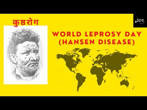 30th January - कुष्ठरोग (Leprosy) - Hansen's Disease | Leprosy Disease In Hindi - Dr. Jasmine Singh