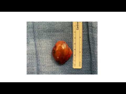 Interesting case of the week: Mistaken Identity with Dr. Kevin Parrack