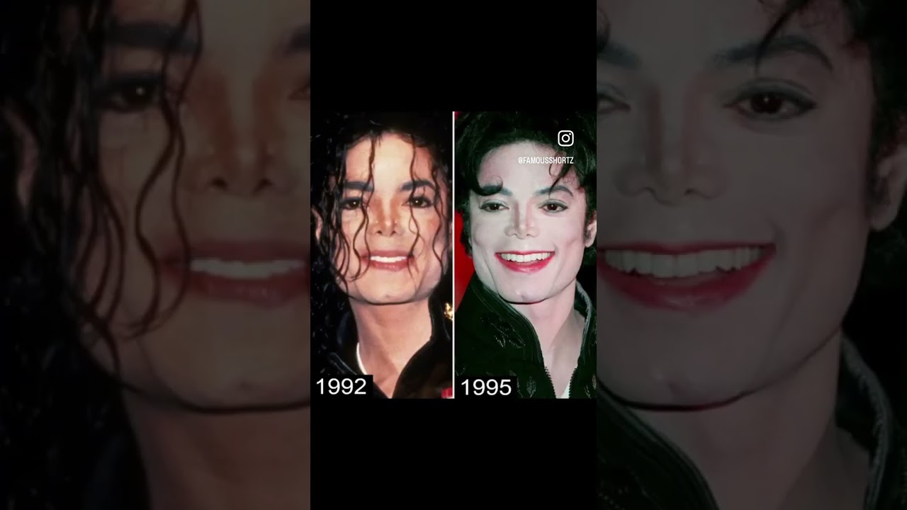 The Evolution of Michael Jackson’s Nose (7+ Nose Jobs)