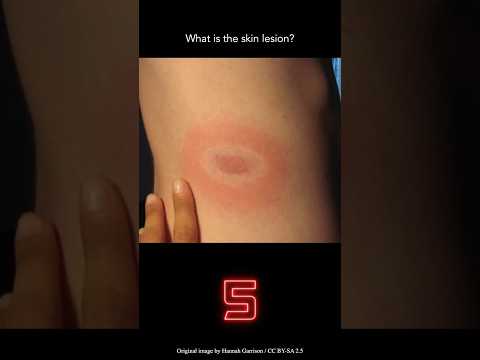 Dermatology Question 1