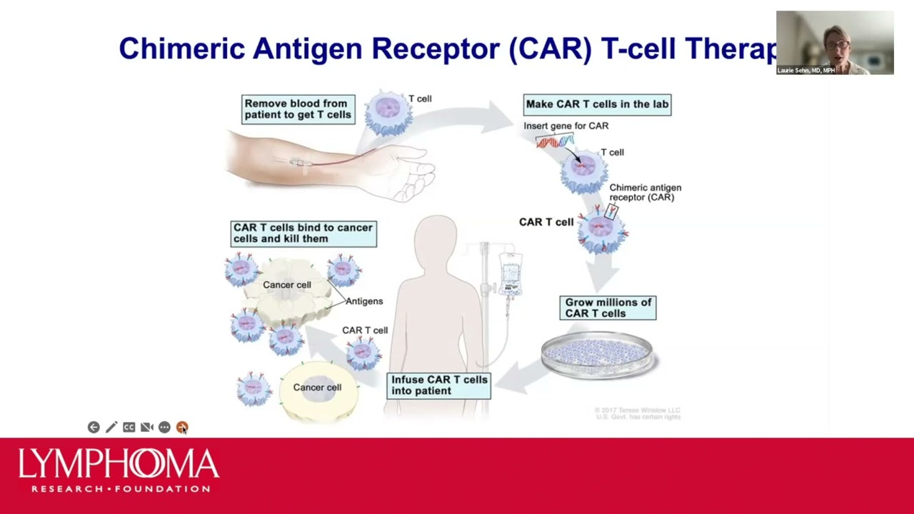 Relapsed and Refractory Diffuse Large B-Cell Lymphoma