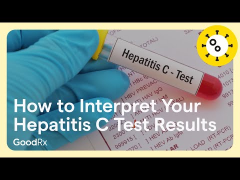 Hepatitis C Testing: How to Interpret Your Results | GoodRx