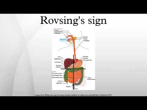 Rovsing's sign