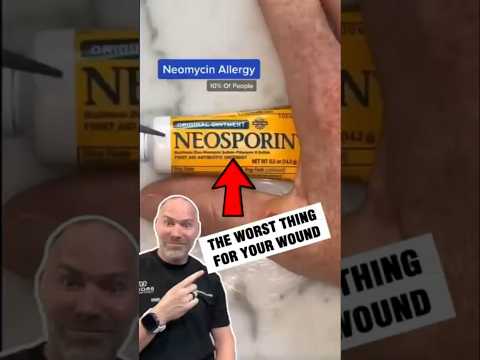Use This Instead of Neosporin!