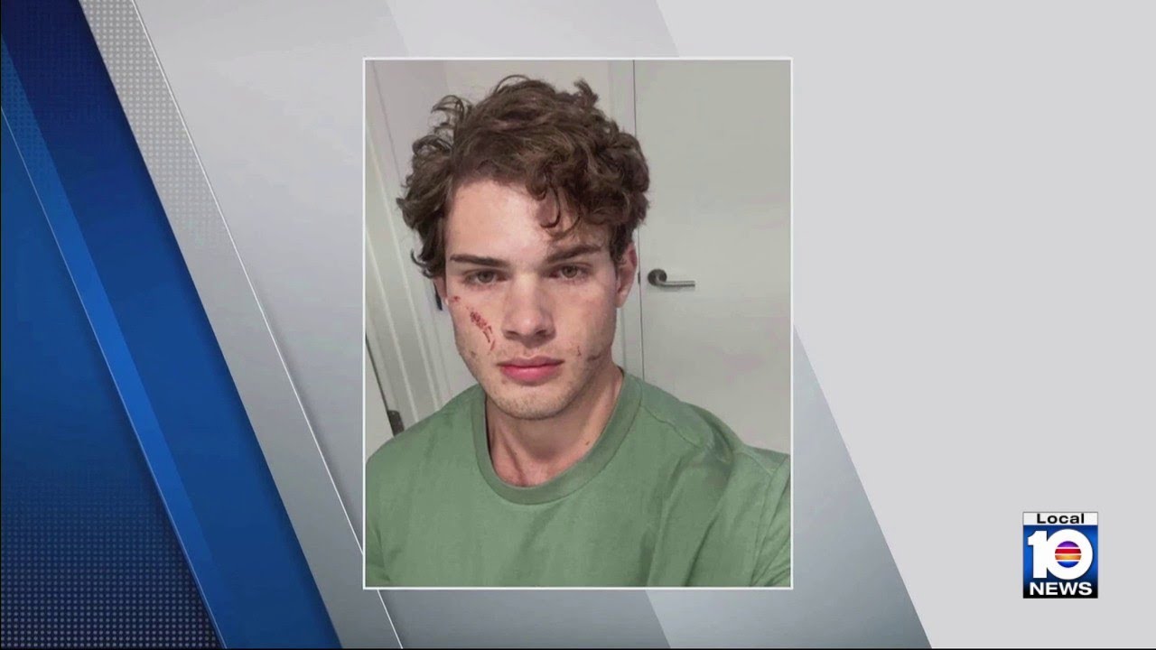 Clavicular breaks silence after reported Miami overdose