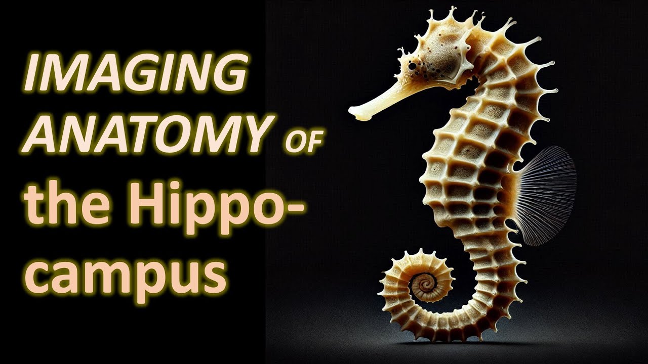 Unforgettable: Radiological Anatomy of the Hippocampus