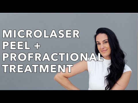 MicroLaser Peel and Profractional Treatment | Nazarian Plastic Surgery