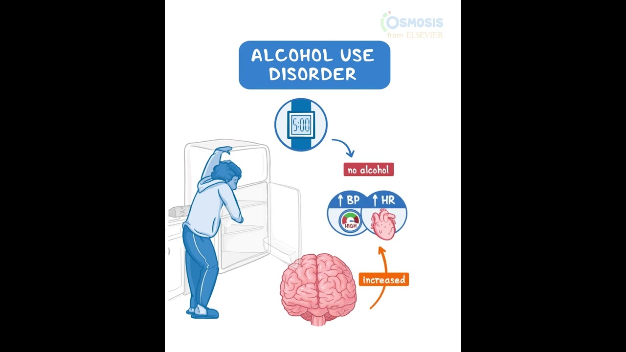 Alcohol Use Disorder