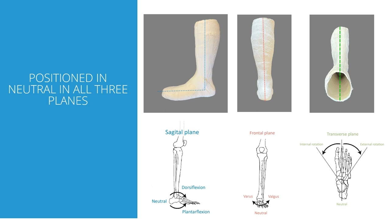 Dynamic Walk Custom Webinar