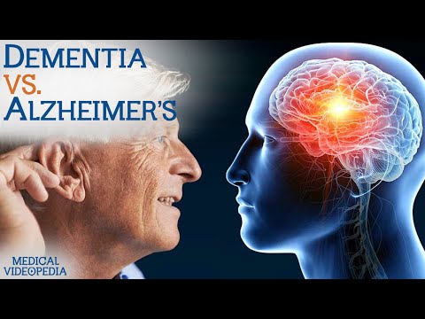Understanding Memory Loss - is it Dementia or Alzheimer's?