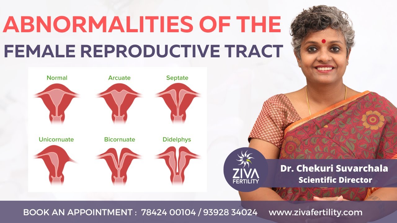 Uterine Defects || Congenital Uterine Abnormalities || Female Infertility || Dr Chekuri Suvarchala