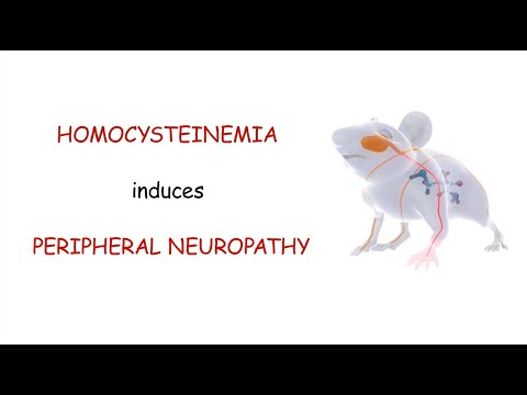 Homocysteinemia induces peripheral neuropathy