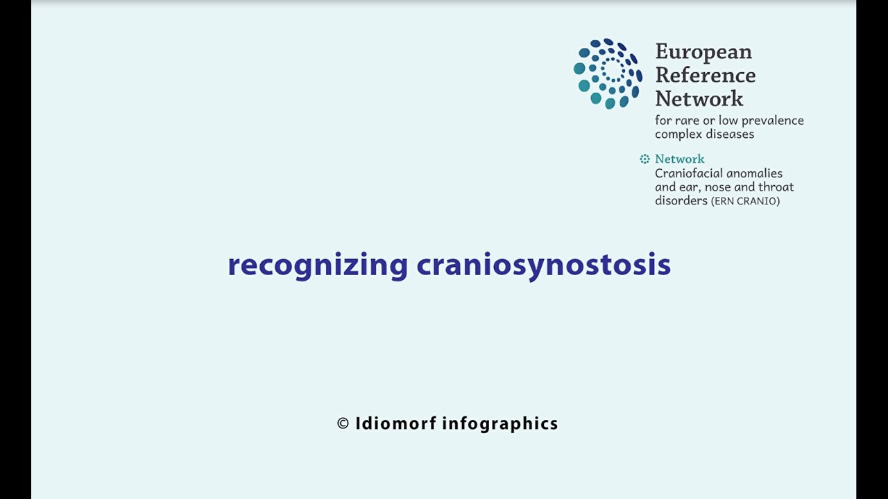 Recognizing craniosynostosis
