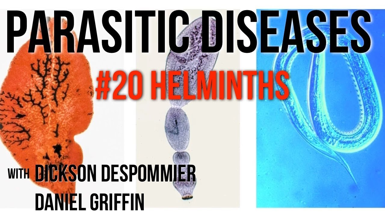 Parasitic Diseases Lectures #20: Helminths