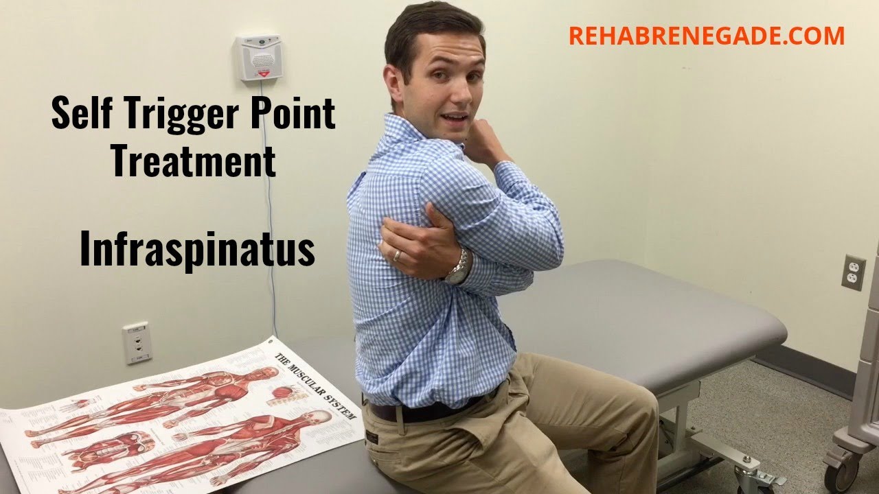Infraspinatus Trigger Point Treatment (Rotator Cuff)