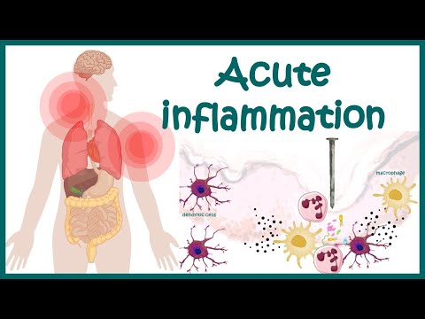 Acute Inflammation | symptoms |Pathogenesis, Cause of inflammation| Mediators of Acute Inflammation.