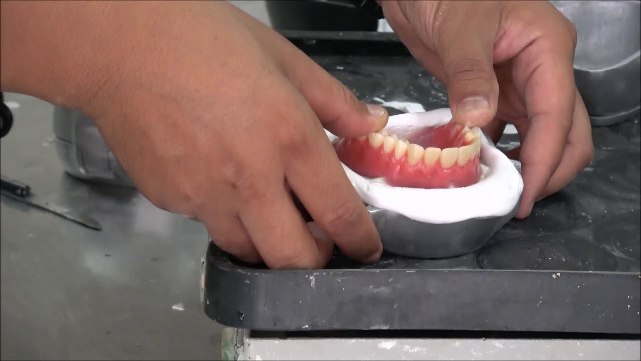 COMPLETE DENTURE: 14. Flasking and Investing