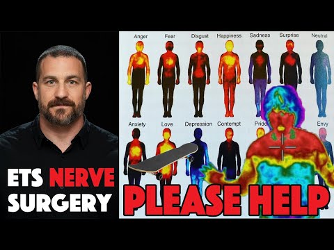 Dr. Andrew Huberman - ETS Sympathectomy Life Destroying Side effects - Please Help