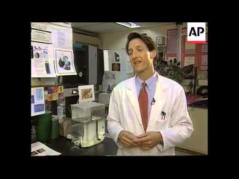 USA: DOCTORS STILL RELYING ON LEECHES