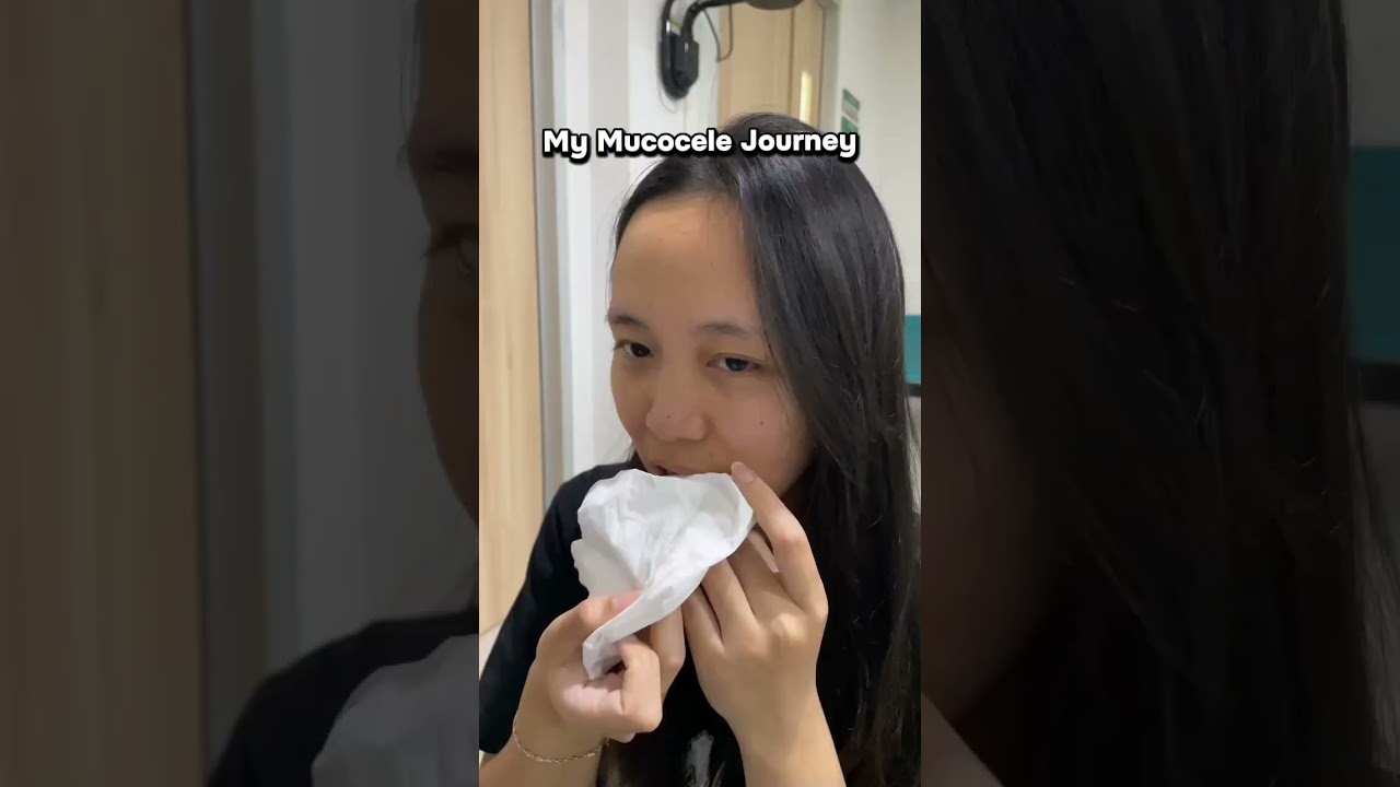 Mucocele Surgery Journey #mucocele #mukokel #operasimukokel #vlog #operasimucocele #surgery