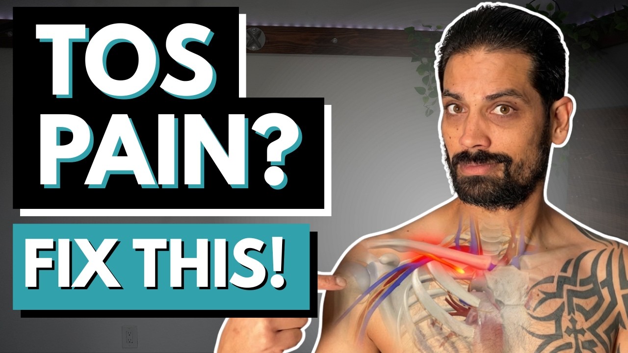 Subclavius Trigger Points: The Hidden Muscle Creating TOS