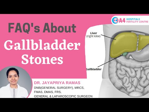 FAQs about Gallbladder stones in tamil by Dr Jayapriya | A4 Hospital | A4 Fertility Centre | Chennai