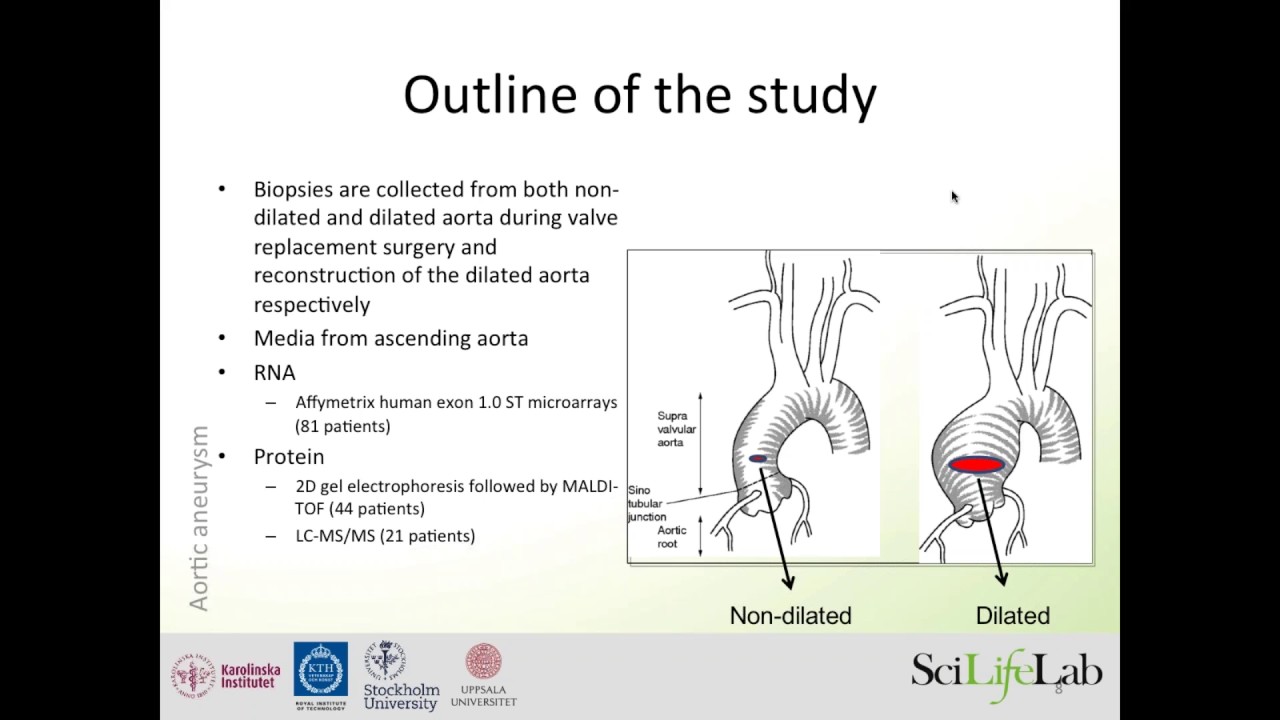 Multivariate Data Analysis in Translational Medicine