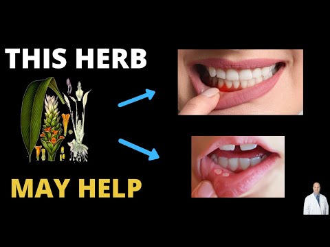 THIS HERB MAY HELP CANKER SORES AND GINGIVITIS