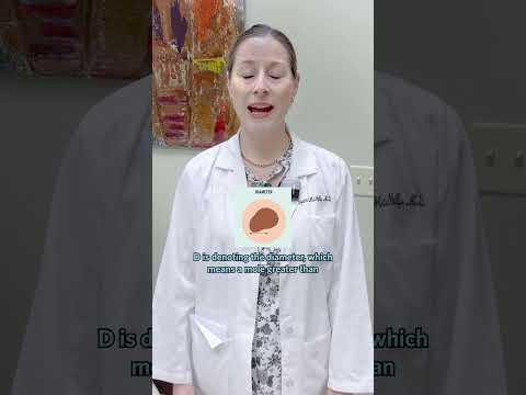 ACBDEs of Melanoma