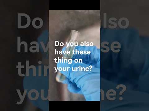 Do you also have these in your urine? #laboratory #whatswrong #urine #microscope #somethingwrong