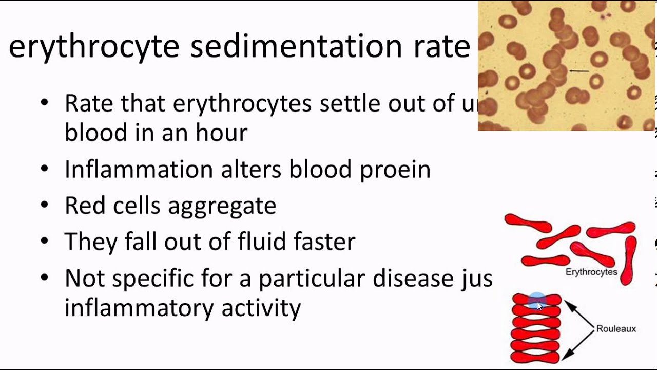 PATHOPHYSIOLOGY essentials EXPLAINED Cardiovascular 4a of 5 anemia