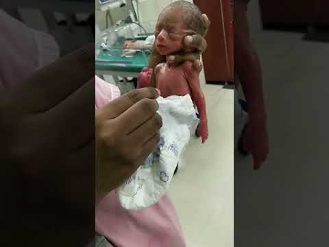 baby of five months ##weight 400grams ## male baby #soo cute small baby##baby is serious plz help ????
