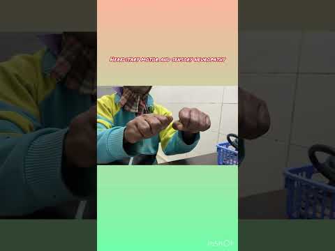 Hereditary motor and sensory neuropathy