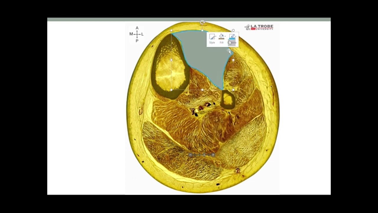 Understanding the Anatomical Relationships of the Leg and Ankle | Galaxy.ai